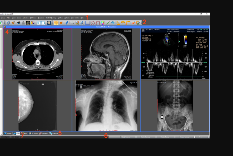 Sante DICOM Viewer Pro 使用教程 – 用户界面介绍 – Sante DICOM Viewer Pro 医学影像浏览器丨 ...